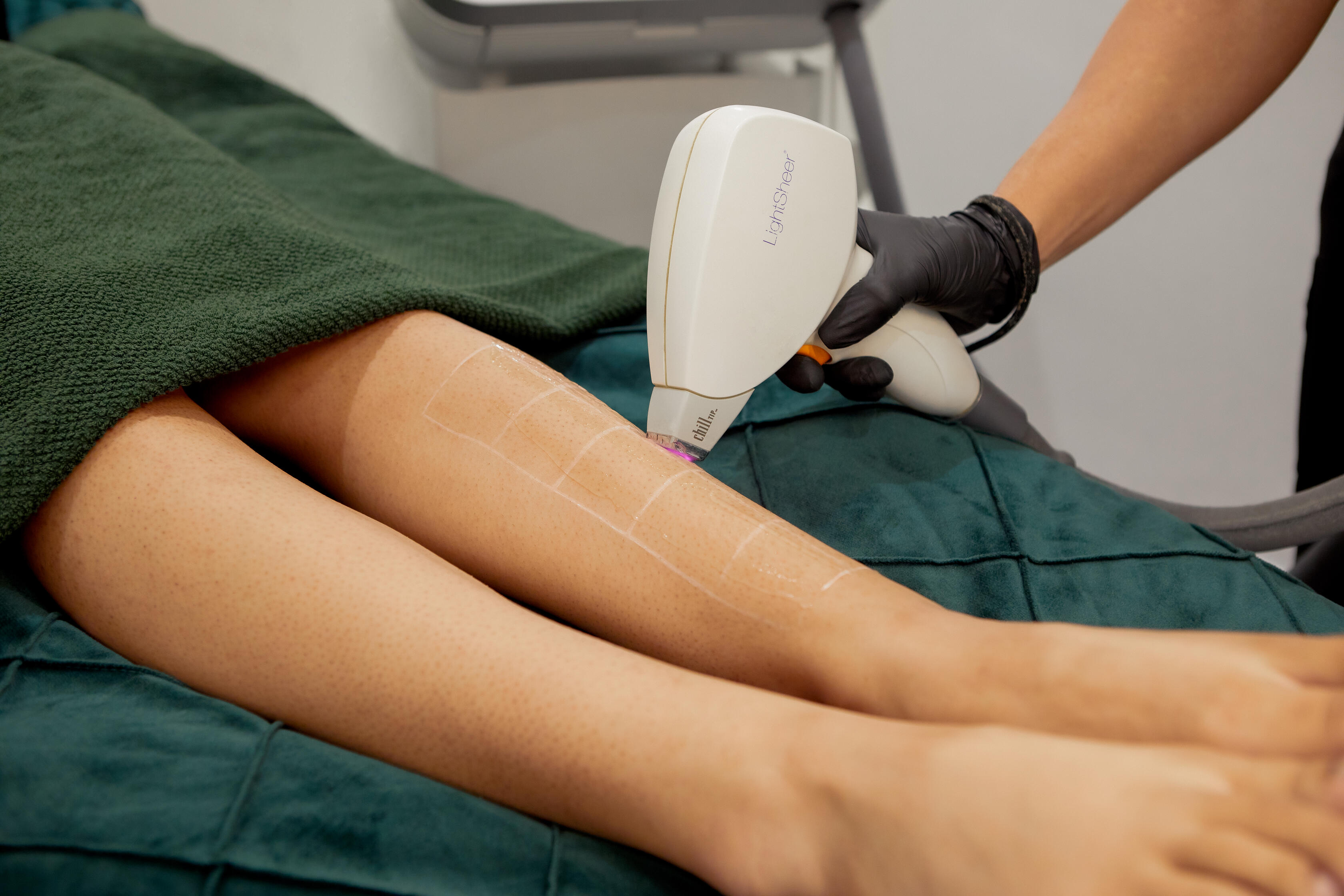 Lumenis LightSheer Upper Leg Laser Hair Removal | The Salon, Skin and ...